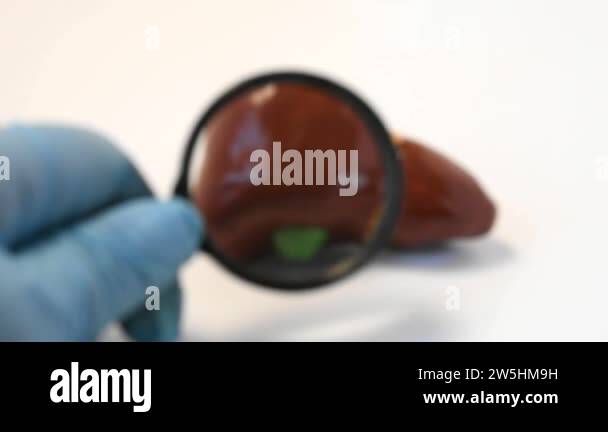 Diagnosis of human liver or hepatic system - body of gland, gallbladder ...