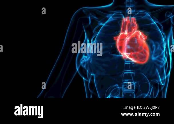 human heart illness xray view, cg medical 3D animation Stock Video ...