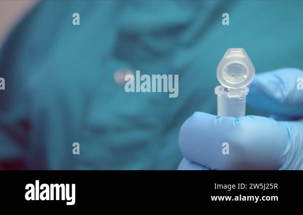 Nurse opens plastic tube puts swab with smear sample inside Stock Video ...