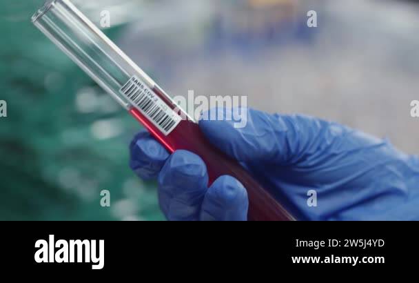 Negative test result hand Stock Videos & Footage - HD and 4K Video ...