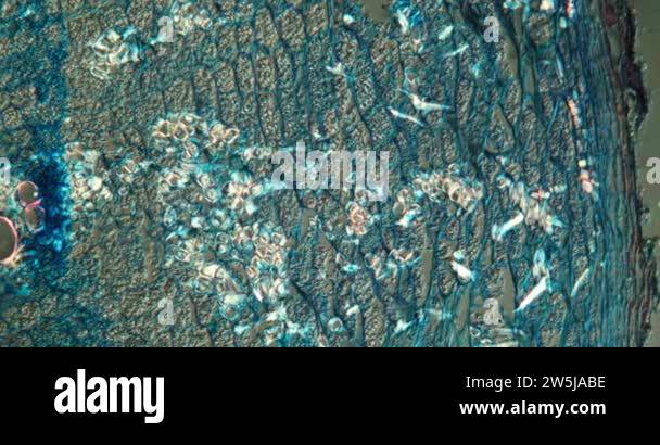lucerne root in cross section under the microscope 100x Stock Video ...