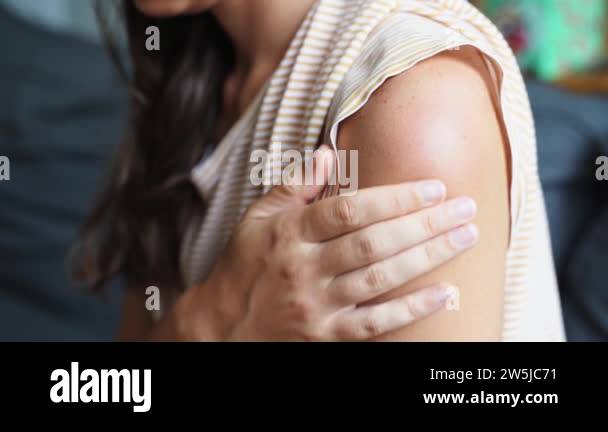Side effect of the vaccine - shoulder skin redness and pain. Covid-19 ...