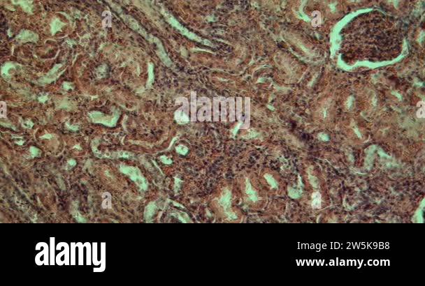 Tuberculosis microscope Stock Videos & Footage - HD and 4K Video Clips ...