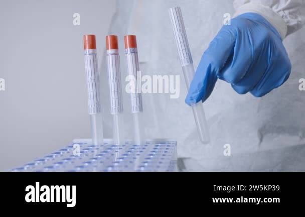 Pcr swab Stock Videos & Footage - HD and 4K Video Clips - Alamy