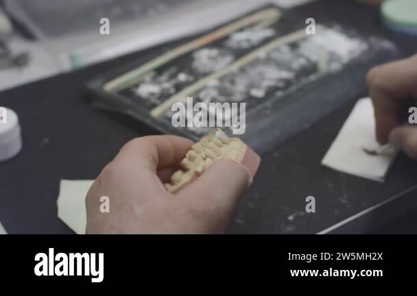 A dentist creates a model of a jaw prosthesis and ceramic teeth in the ...