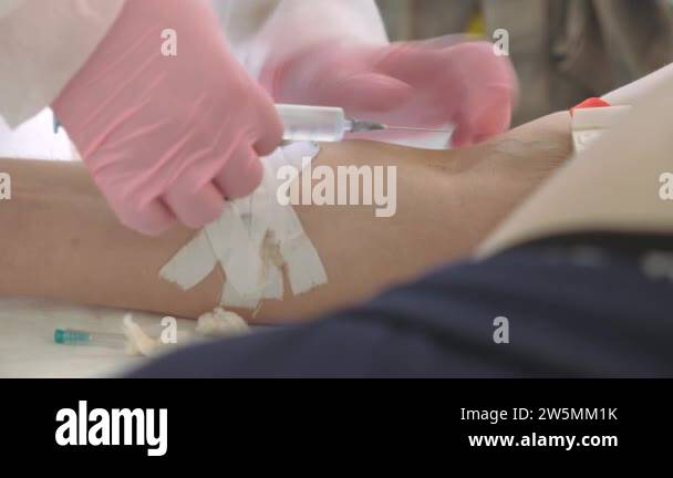 Intravenous injection. Bad veins. Doctor cant find a vein to inject ...