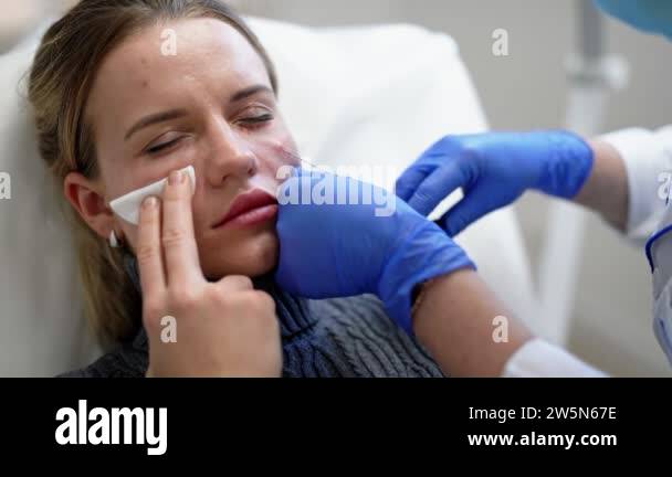 Plastic surgery cosmetic botox injection Stock Videos & Footage - HD ...