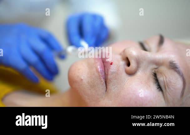 Receiving procedure Stock Videos & Footage - HD and 4K Video Clips - Alamy