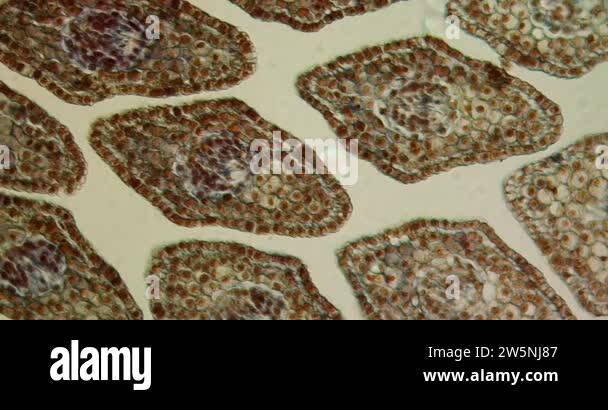 Spruce shoot tip with needles in cross section under the microscope ...