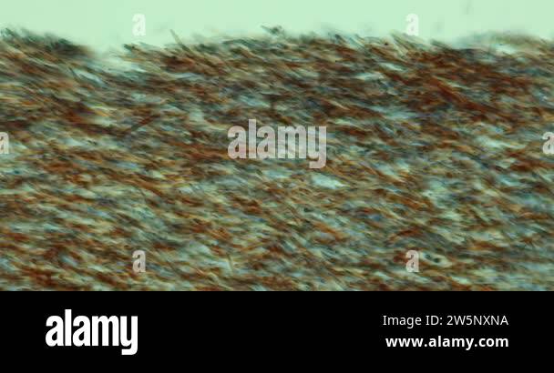 Black foot poorling, fruiting body of the fungus in cross section under ...