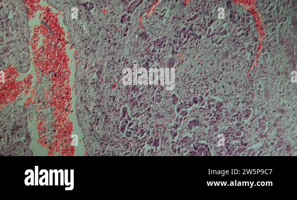 Mushroom poisoning Stock Videos & Footage - HD and 4K Video Clips - Alamy