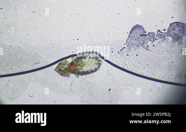 Body louse skin microscope Stock Videos & Footage - HD and 4K Video ...
