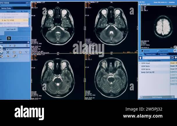 MRI program interface during brain scanning Stock Video Footage - Alamy
