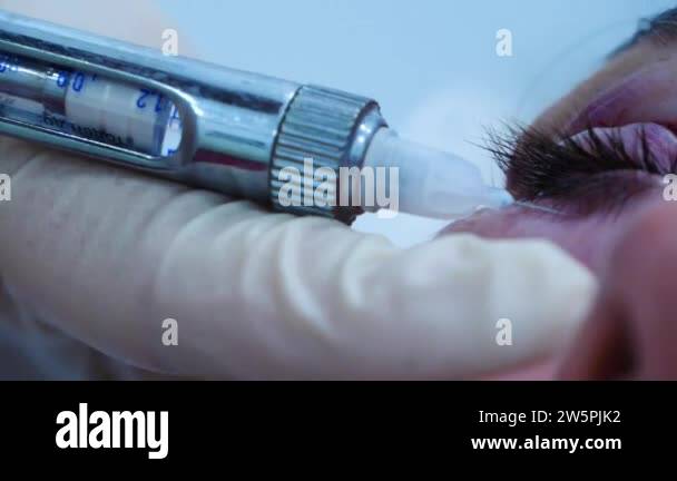 Close up of a surgeon puts an injection in the patient eye. Plastic ...