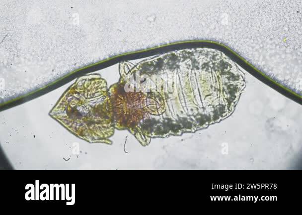 Head lice under the microscope. Skin flea under magnification. The ...