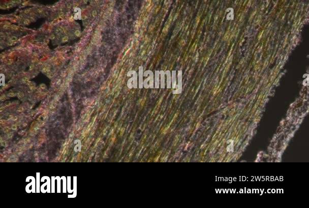 Intestinal cross section in Darkfield tissue under the microscope 200x ...