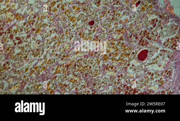 Pituitary gland microscope Stock Videos & Footage - HD and 4K Video ...