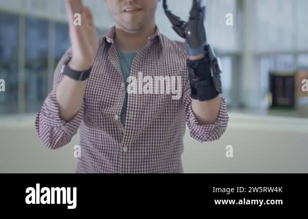 A man with a prosthetic arm. Artificial robotic arm, replaces hand and ...