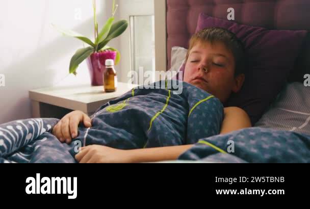 Viral disease. Measles rash. Child with viral infection measles lies in ...