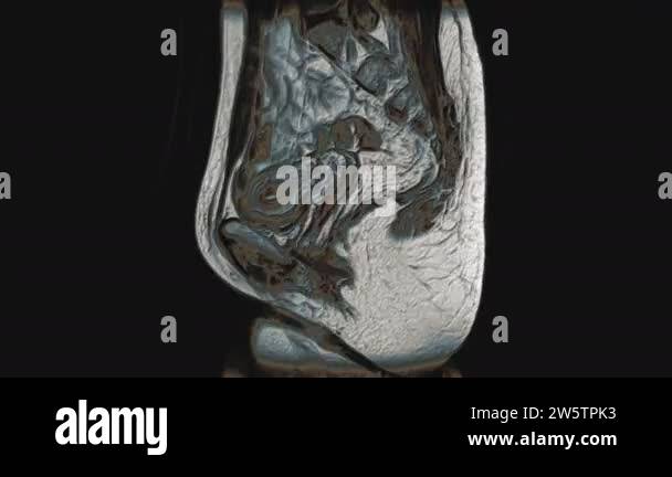 Bulk multicolored MRI of the female pelvic organs, abdominal cavity ...