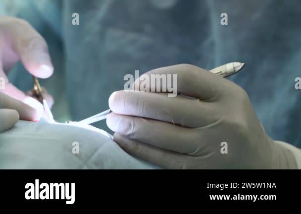Close-up of doctors hands performing complex operation. Action ...