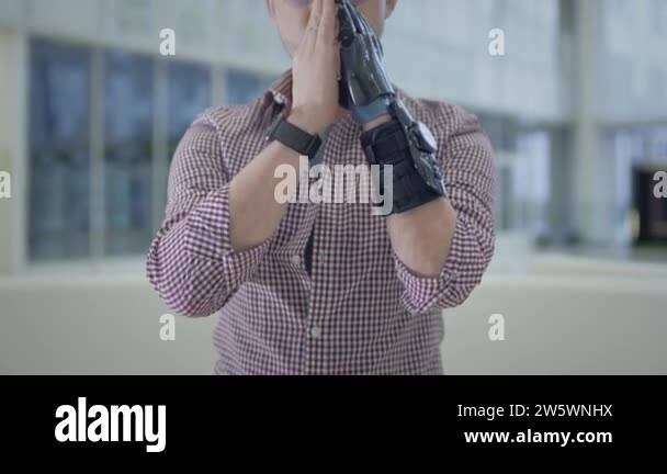 A man with a prosthetic arm. Artificial robotic arm, replaces hand and ...
