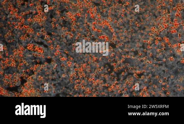 lung AIDS fungi tissue in Darkfield tissue under the microscope 200x ...