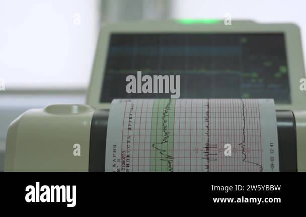 Electronic Cardiotocography Machine Monitoring Fetal Heart Contractions ...