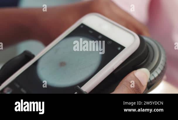 Dermatologist Examines A Skin. Professional Doctor The Dermatologist ...