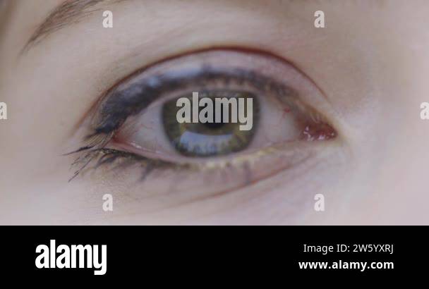 Close up female green eye looking at camera and blinking, eyesight surgery and dry eye syndrome ...