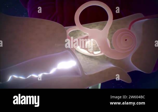 Hearing sound waves Stock Videos & Footage - HD and 4K Video Clips - Alamy