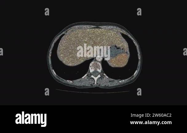 Bulk multicolored MRI of the female pelvic organs, abdominal cavity ...