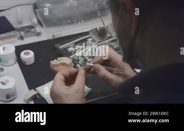A dentist creates a model of a jaw prosthesis and ceramic teeth in the ...