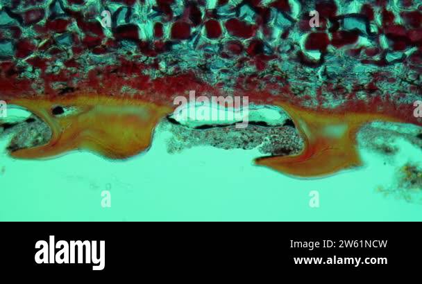 Disease of fish Stock Videos & Footage - HD and 4K Video Clips - Alamy