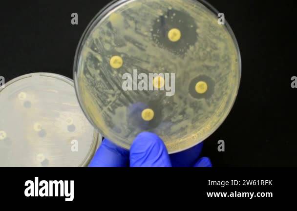 Antibiogram antibiotic sensitivity test Stock Videos & Footage - HD and ...