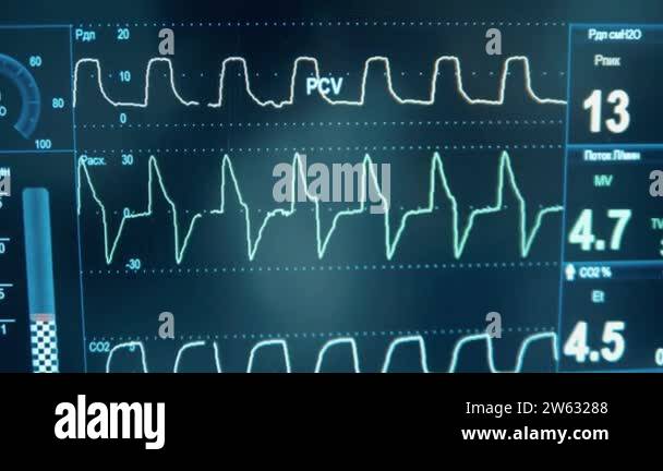 Screen of a medical monitor displaying diagrams of vital signs Stock ...