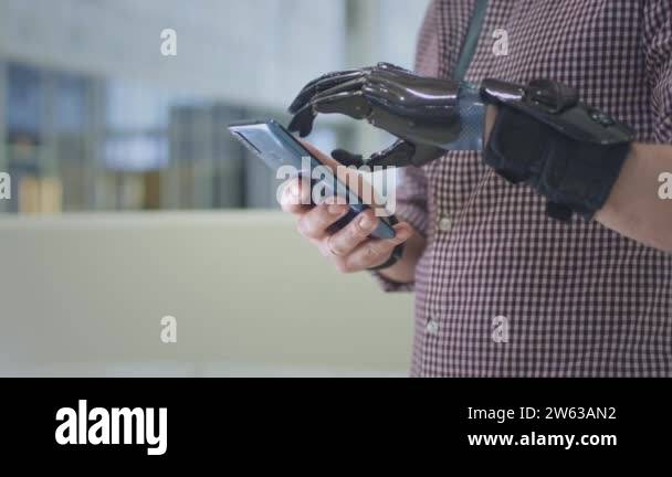 A young man with a prosthetic arm uses a smartphone. A disabled person ...