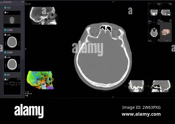 Computed tomography analysis Stock Videos & Footage - HD and 4K Video ...