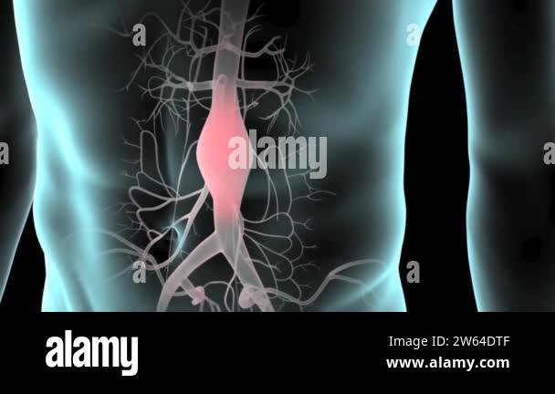 Close up of the abdominal area of a human male shown with transparent ...