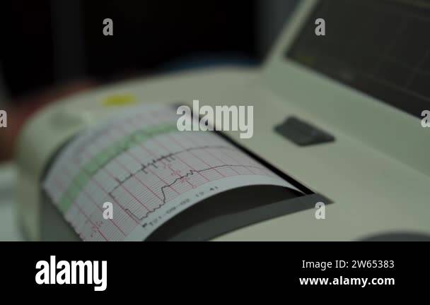 Electronic Cardiotocography Machine Monitoring Fetal Heart Contractions ...