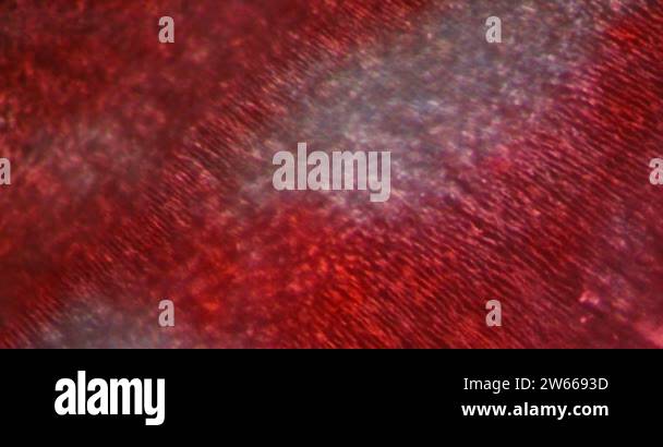 Tooth, tooth decay in Darkfield tissue under the microscope 200x Stock ...