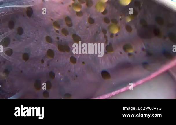 3D animation of Helicobacter pylori gastritis and ulcers causing ...