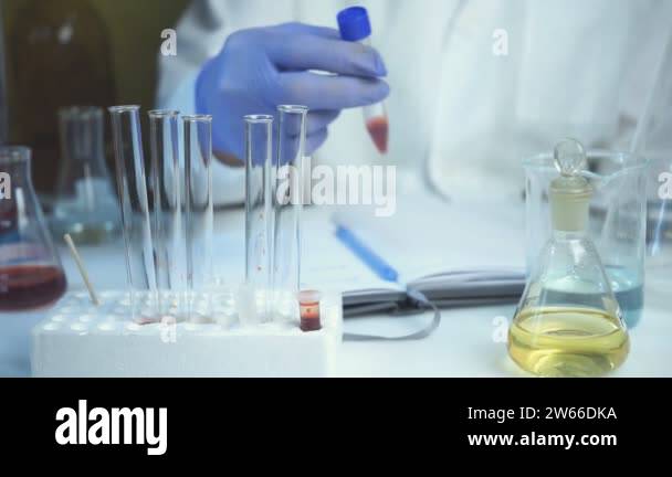 Scientist tests blood and adds test tube in rack at lab. Concept of ...