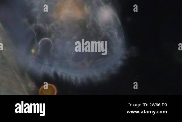 The rotifers commonly called wheel animals or wheel animalcules, make ...