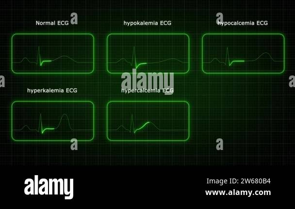 Green light glowing lifeline animation. Electric neon lighting follow ...