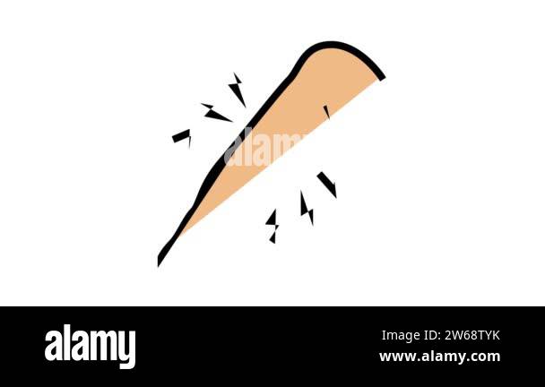 Edema Disease Symptom color icon animation Stock Video Footage - Alamy