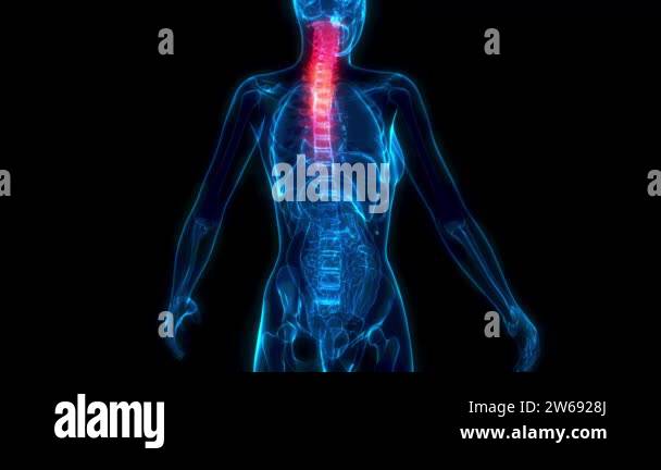 Cervical, top part of human spine on x-ray scan of body Stock Video ...