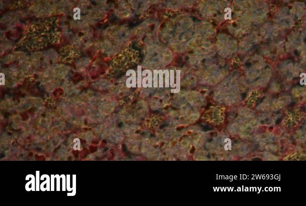 pituitary gland tissue in Darkfield tissue under the microscope 200x ...