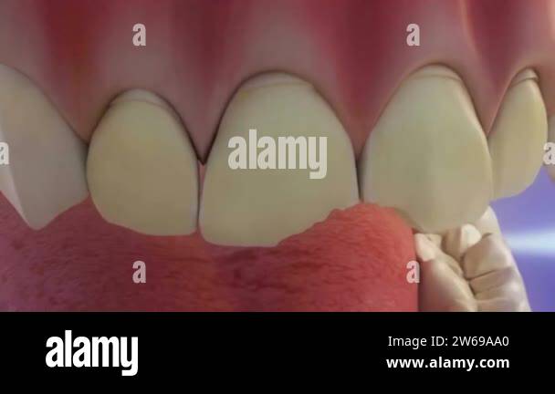 Care of your teeth Stock Videos & Footage - HD and 4K Video Clips - Alamy