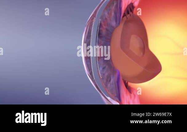 Photopsia Stock Videos & Footage - HD and 4K Video Clips - Alamy